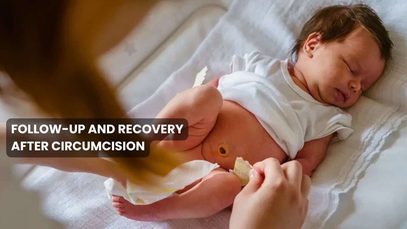 Circumcision Guide: Preparation, Procedure, Benefits, and Risks